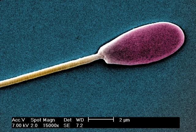 South African Springbok | San Diego Zoo Wildlife Alliance