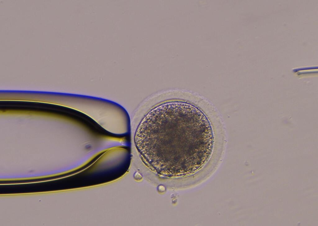 Putting eggs in a basket, step 2: Make the eggs happy – oocyte ...
